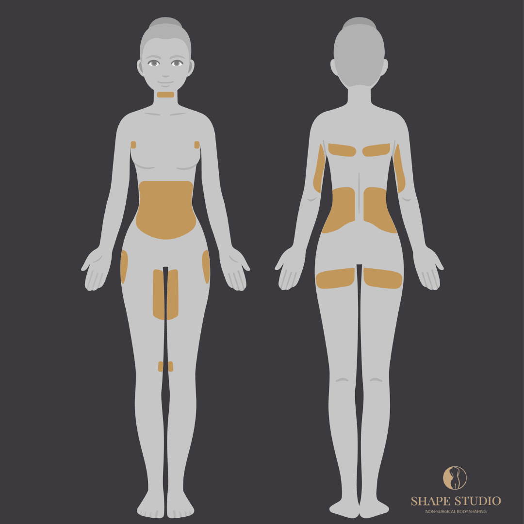 Body Shaping Treatments | Non Surgical Body Shaping & Sculpting